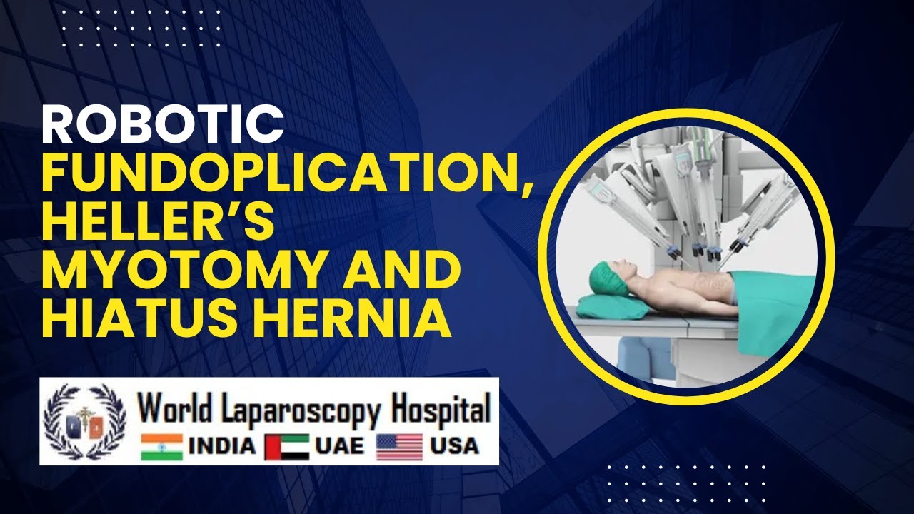 Robotic Fundoplication, Heller’s Myotomy and Hiatus Hernia Lecture ...
