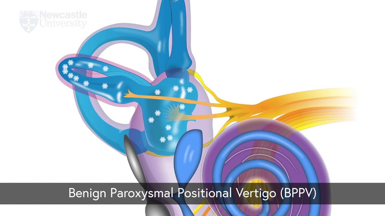 Dizziness: what are the main causes? - YouTube