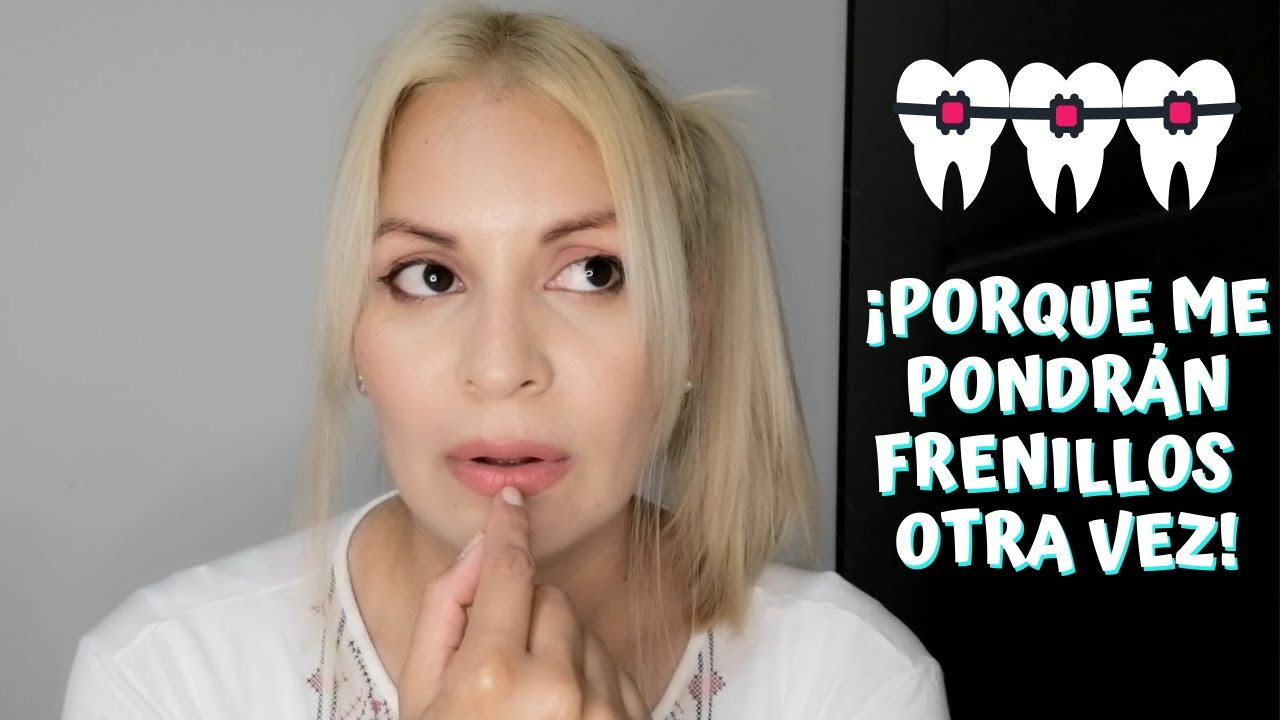 😣😅🦷 ¡PORQUE ME TUVIERON QUE PONER FRENILLOS OTRA VEZ! - YouTube