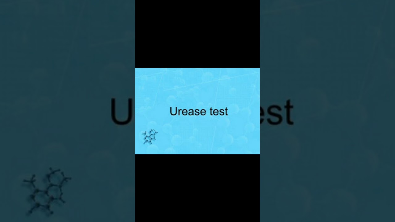 Urease test - YouTube