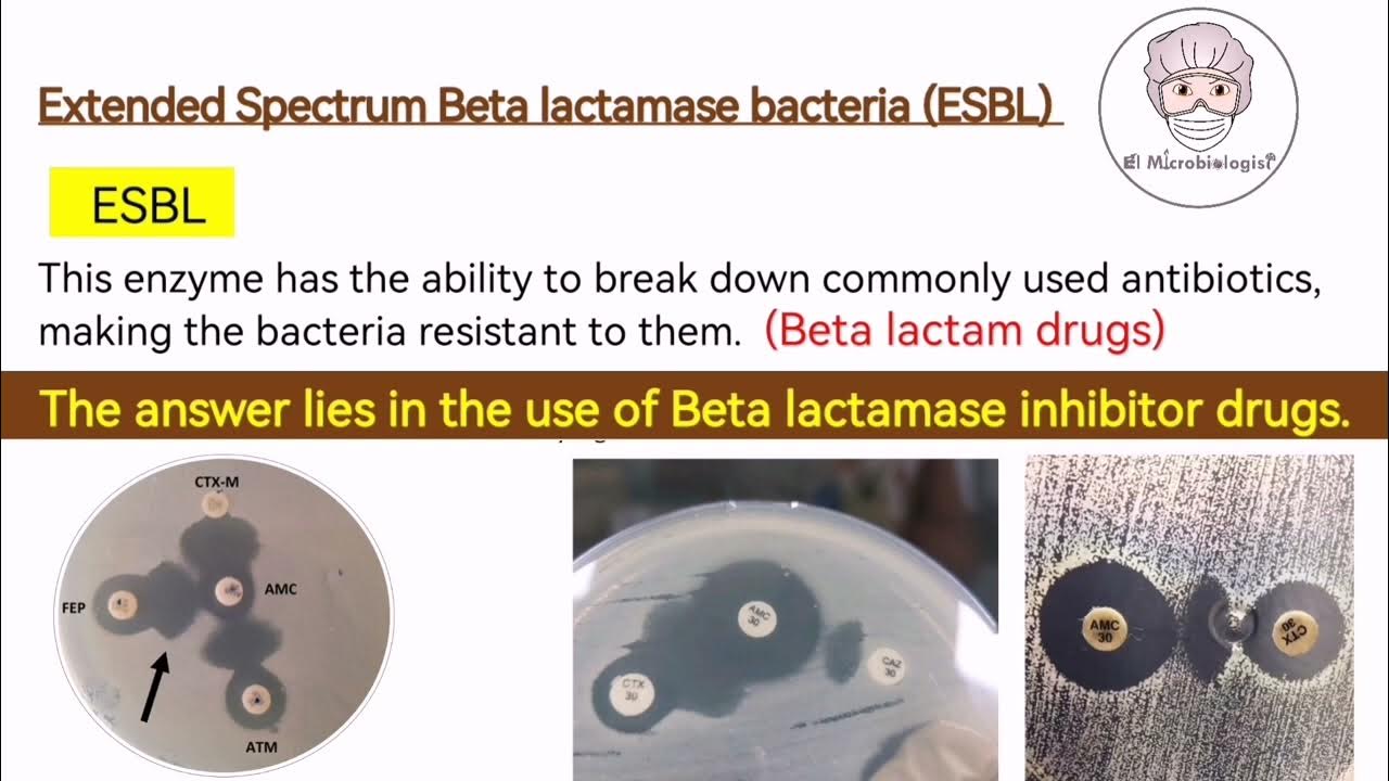ESBL bacteria (Extended Spectrum Beta-lactamase Bacteria) - Antibiotic Resistance (English ...