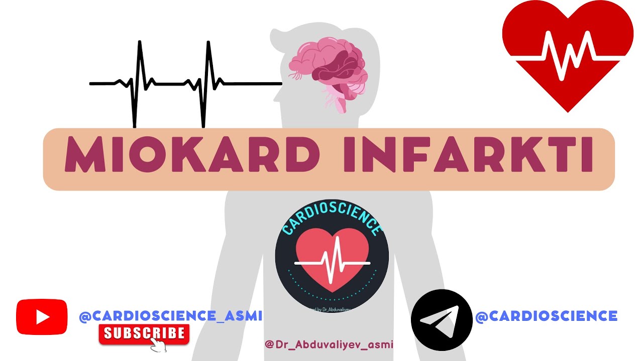 1-Online webinar. Miokard infarkti - YouTube