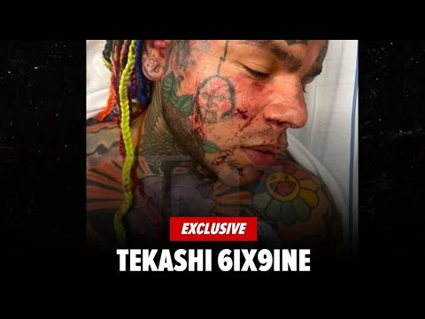 Tekashi 6ix9ine brutally attacked and sent to hospital #69 #Takashi # ...