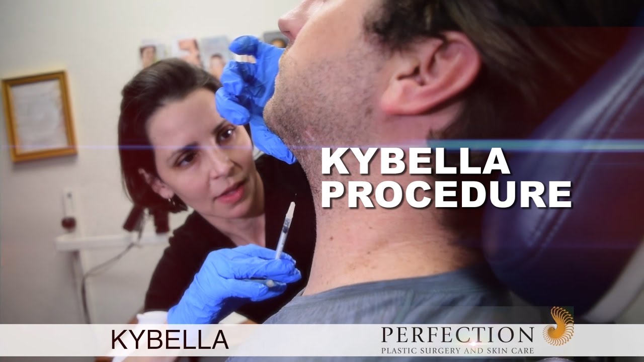 Kybella Procedure 2017: Patient feedback from Tucson, AZ - YouTube