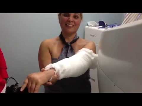 Total Elbow Replacement Surgery Outpatient Procedure - Dr. Alejandro ...