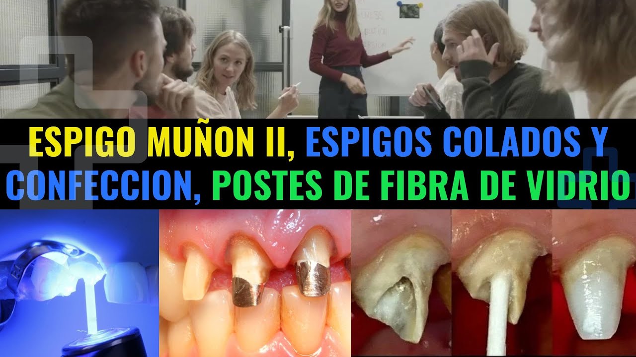 𝗘𝗦𝗣𝗜𝗚𝗢 𝗠𝗨𝗡̃𝗢𝗡 𝗜𝗜, 𝗘𝗦𝗣𝗜𝗚𝗢𝗦 𝗖𝗢𝗟𝗔𝗗𝗢𝗦 𝗬 𝗖𝗢𝗡𝗙𝗘𝗖𝗖𝗜𝗢𝗡, 𝗣𝗢𝗦𝗧𝗘𝗦 𝗗𝗘 𝗙𝗜𝗕𝗥𝗔 𝗗𝗘 ...