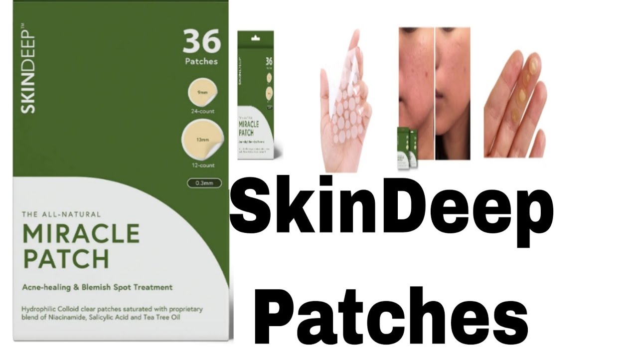 MIRACLE PATCH - Acne Healing & Blemish Spot Treatment REVIEW - YouTube