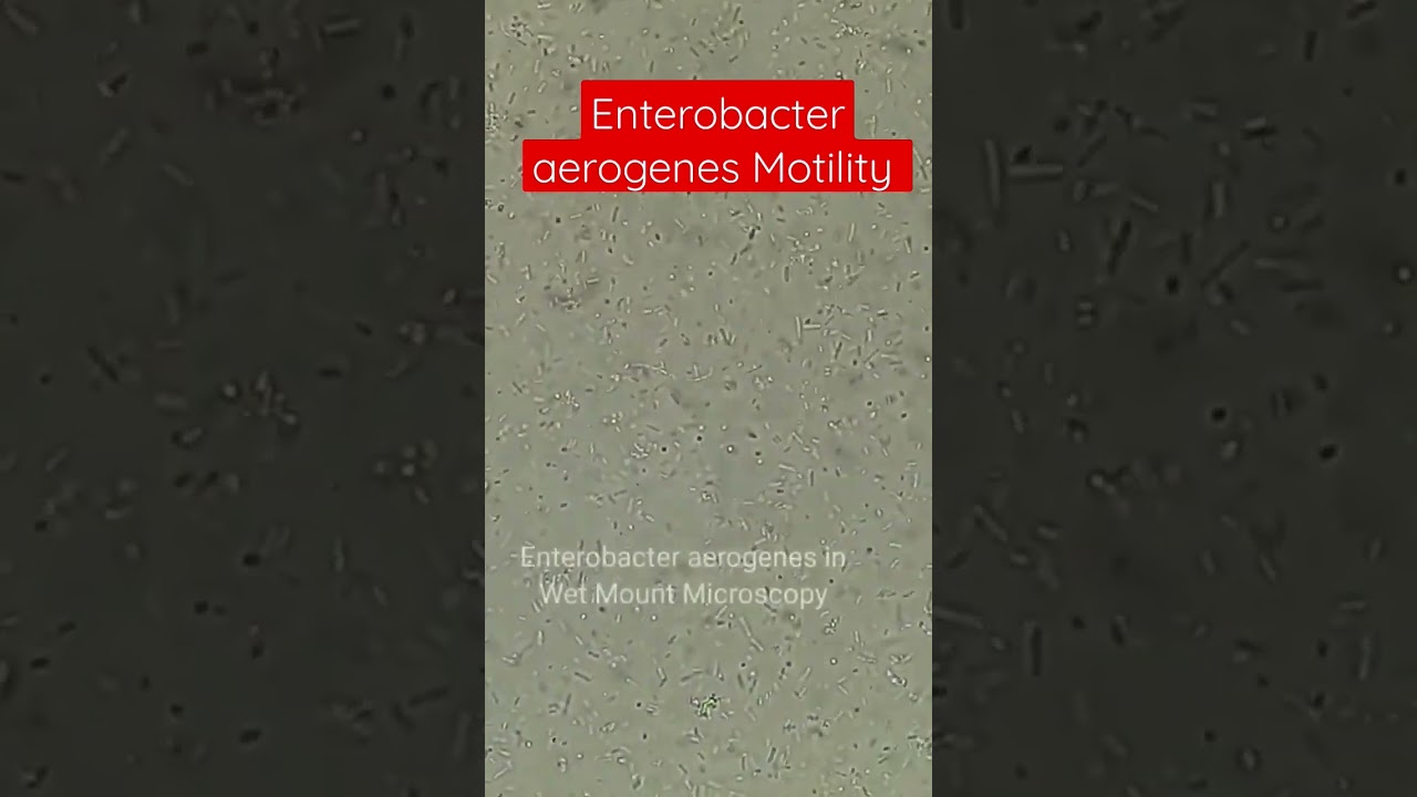 Enterobacter Aerogenes Motility Test