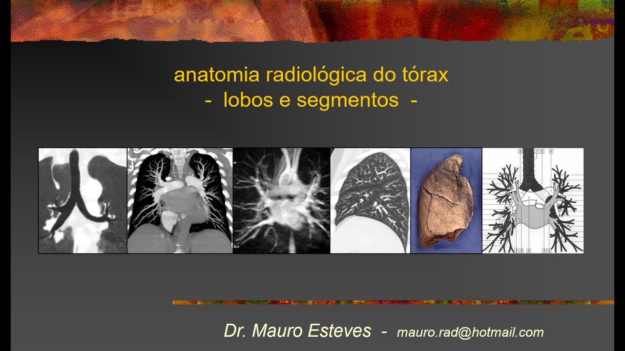 Anatomia - Lobos e segmentos pulmonares - YouTube