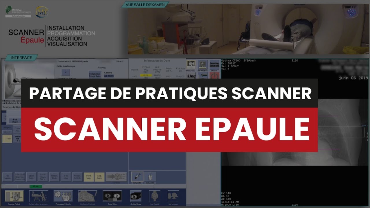 CT SCANNER EPAULE - Partage de pratique - YouTube