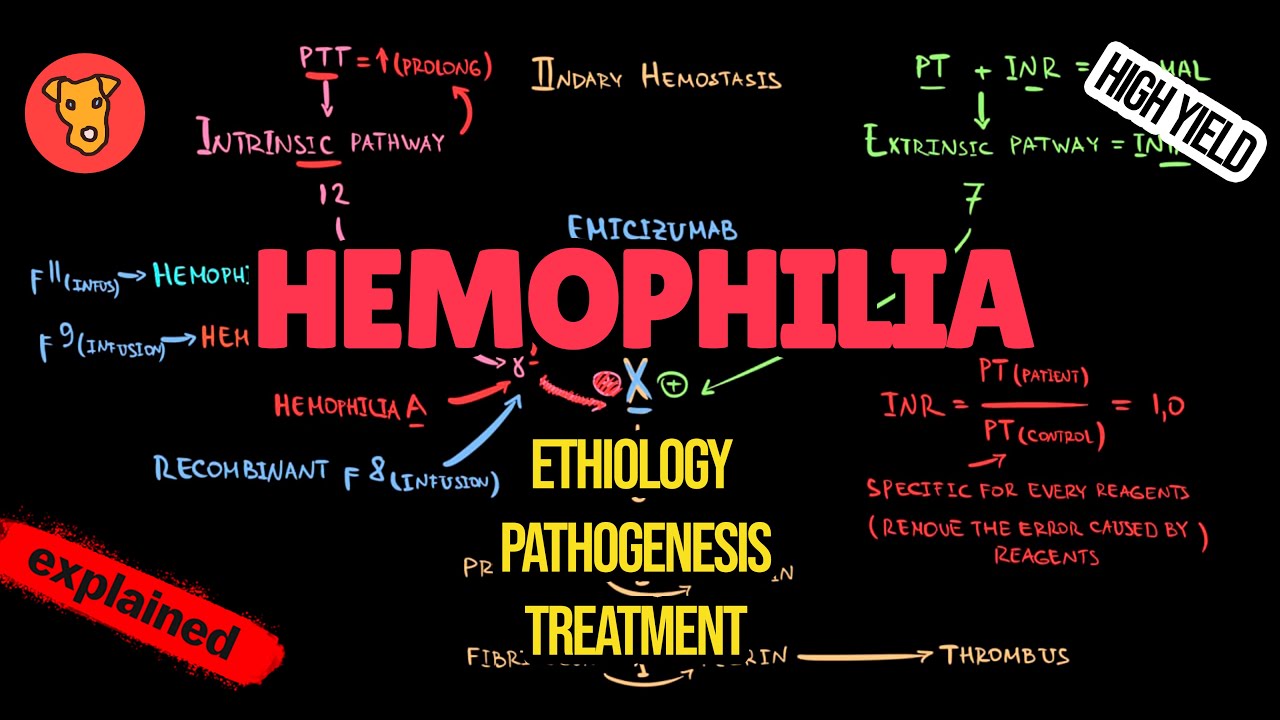 HEMOPHILIA Pathogenesis Mechanism of clinical symptoms Treatment - YouTube