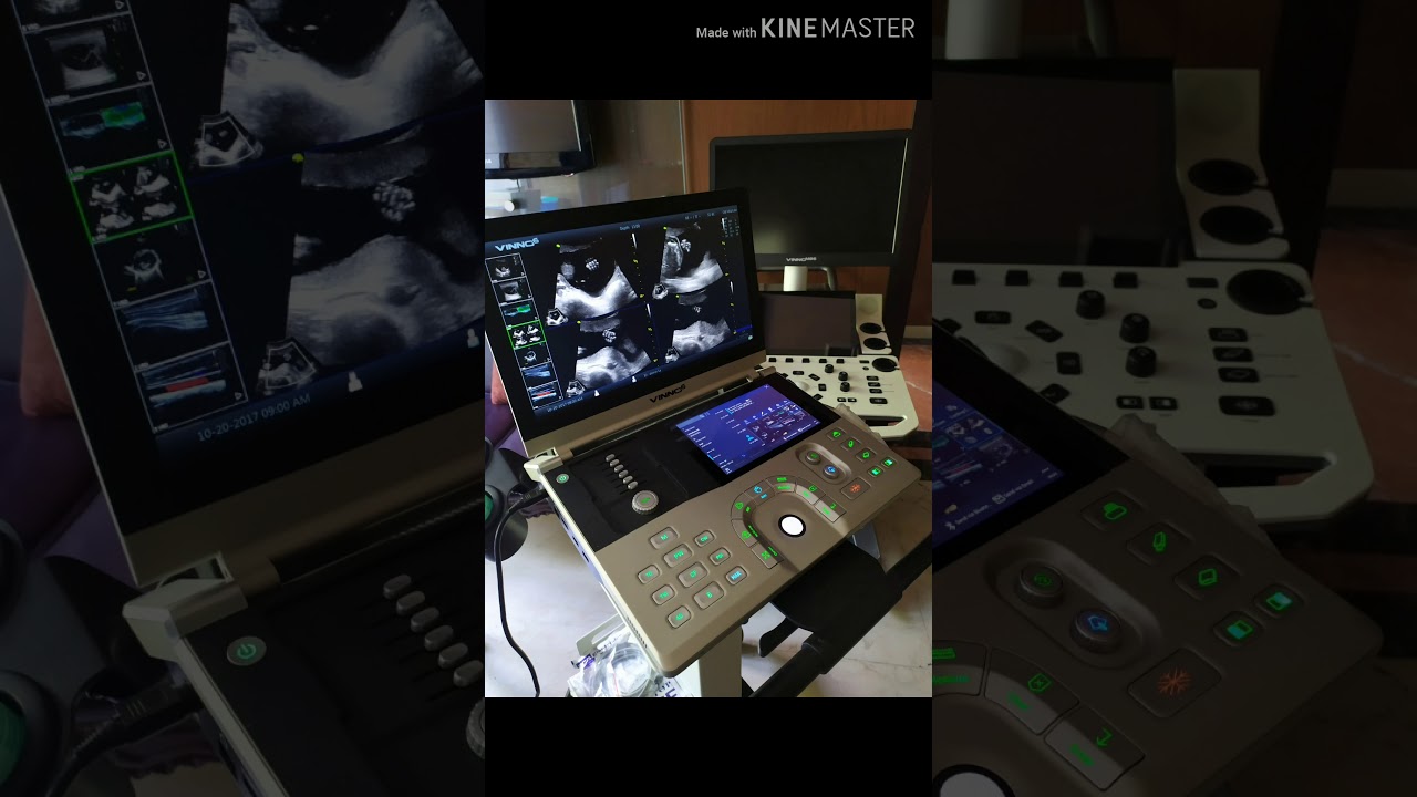 VINNO Ultrasound Portable - YouTube