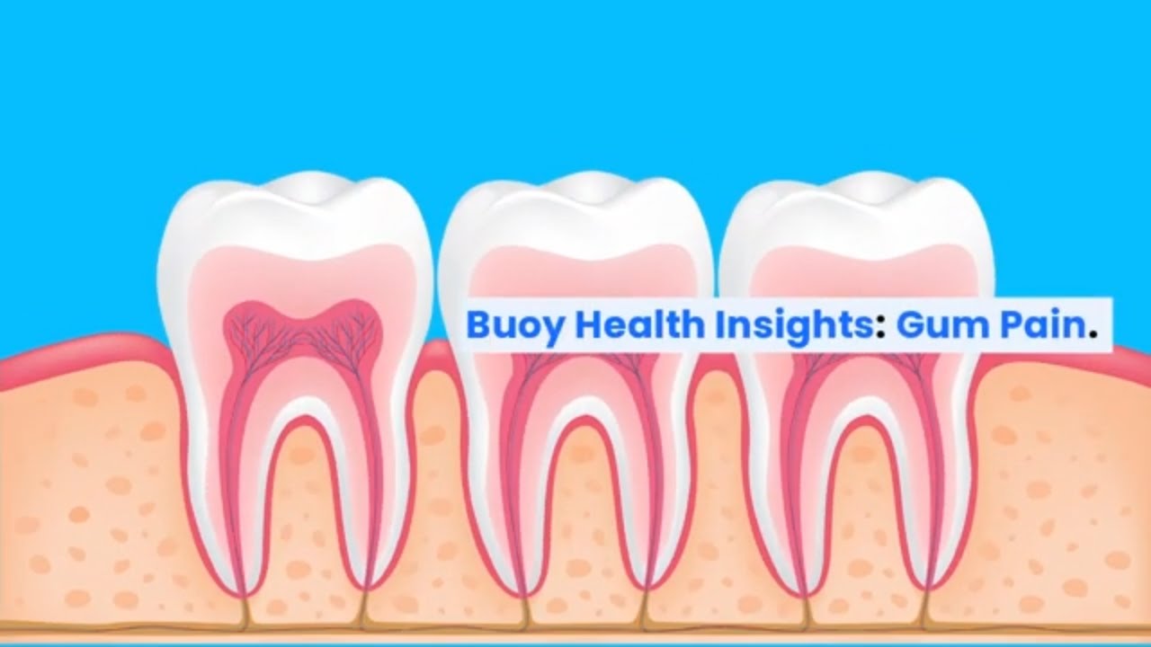 Gum Pain: Common Causes and When to Seek Medical Care | BuoyHealth.com ...