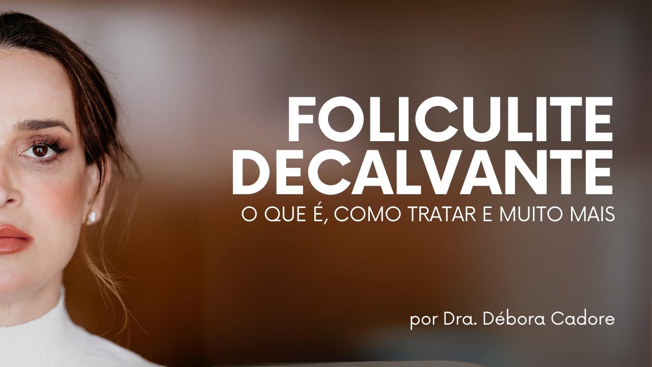 Foliculite Decalvante: o que é e como tratar essas espinhas no couro ...