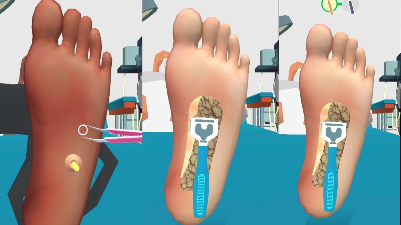 🤯 Playing Doctor Dash Foot Surgery Game 😱 @android wala gamer - YouTube