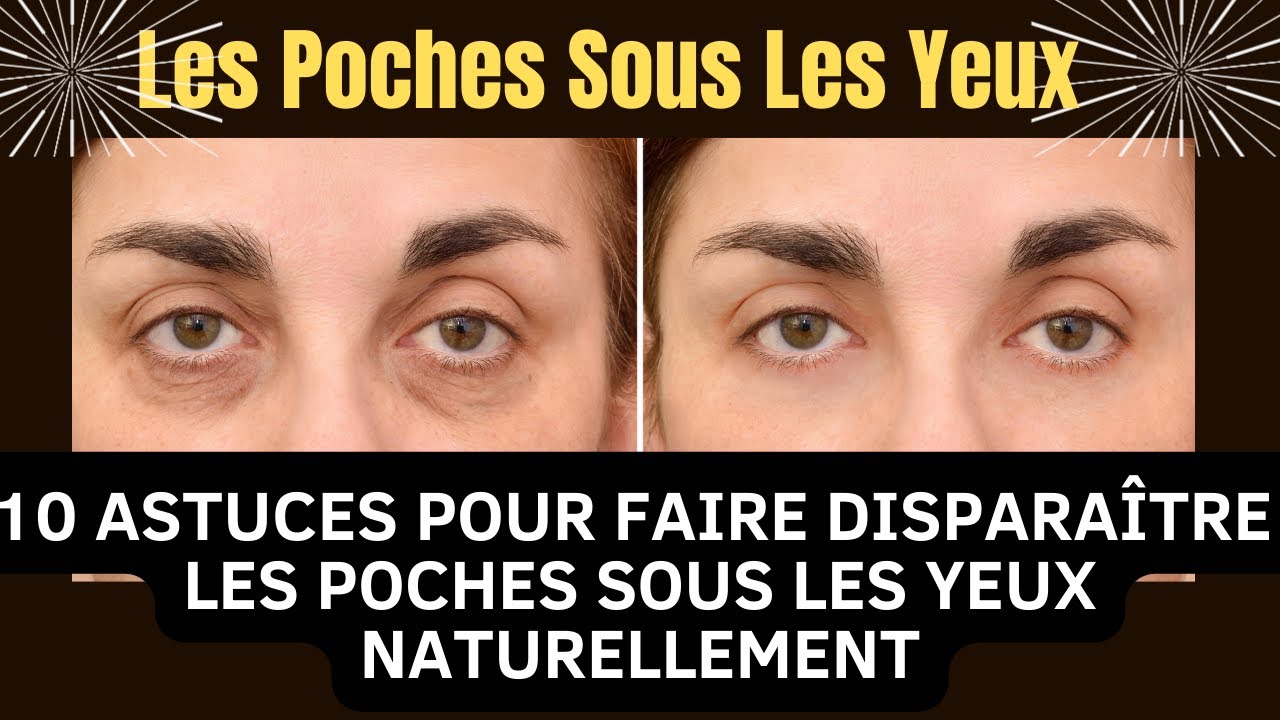 Comment faire disparaître les poches sous les yeux naturellement et ...