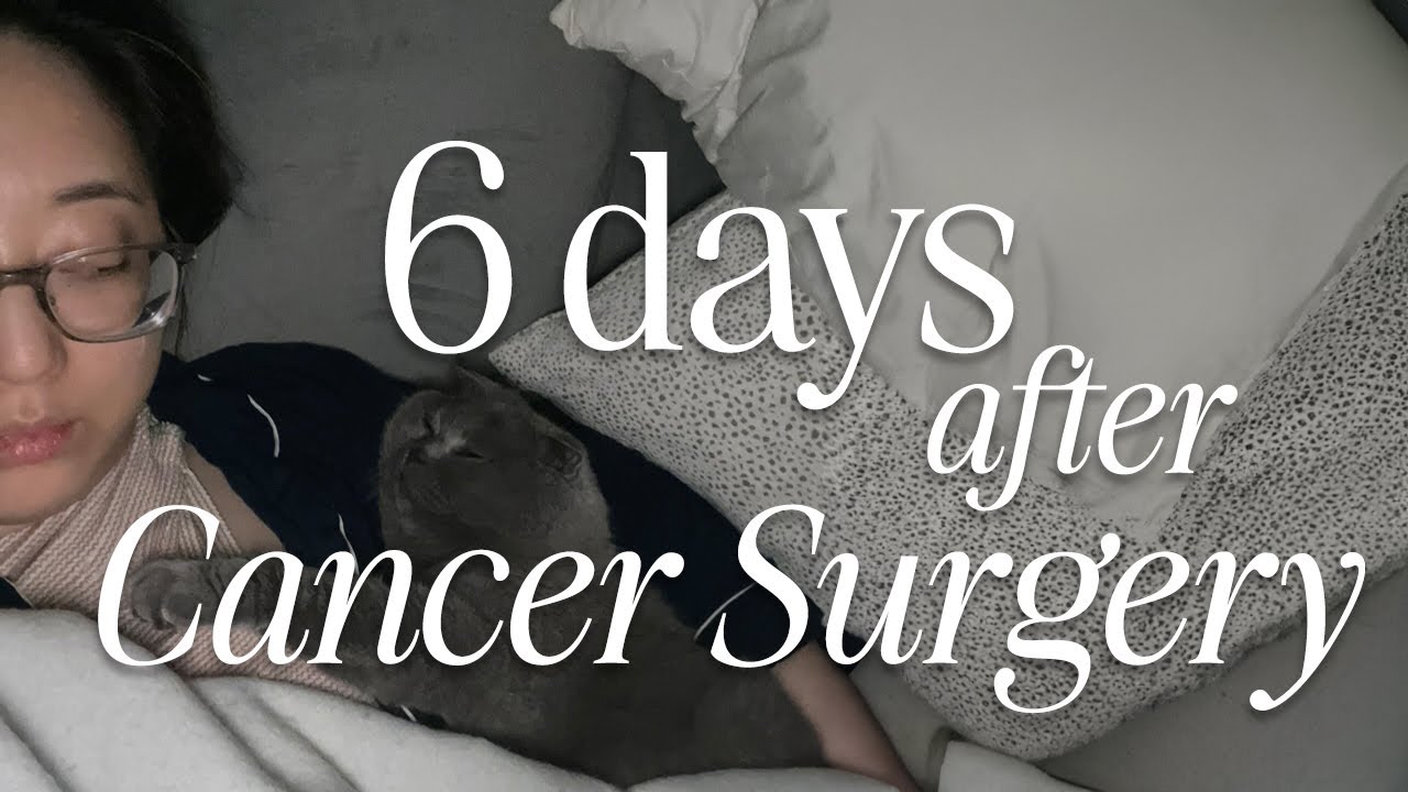 For Thyroid Cancer After Surgery – IXXLIQ