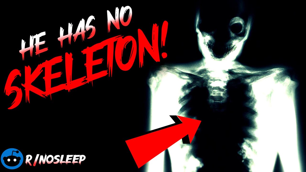 I m An X ray Tech And One Of My Patients Is Missing His Skeleton R i-m-an-x-ray-tech-and-one-of-my-patients-is-missing-his-skeleton-r