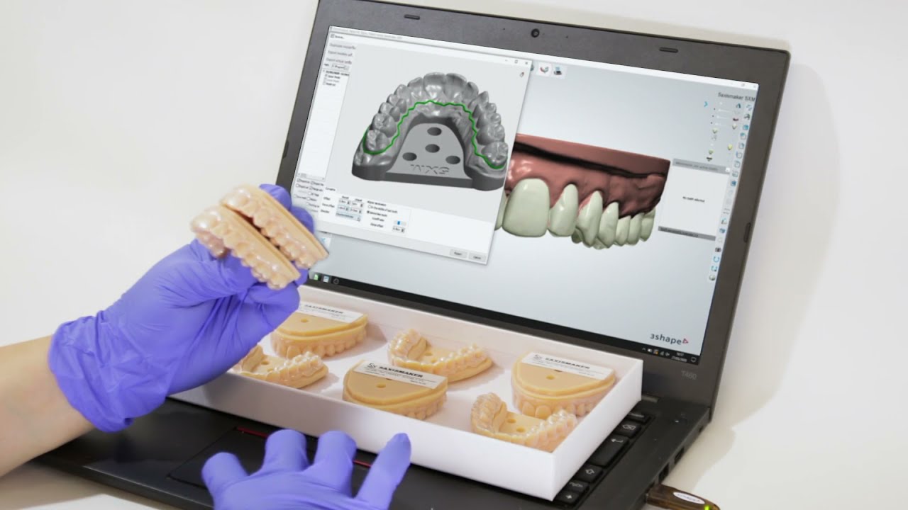 5XM 3shape Integration Workflow - YouTube