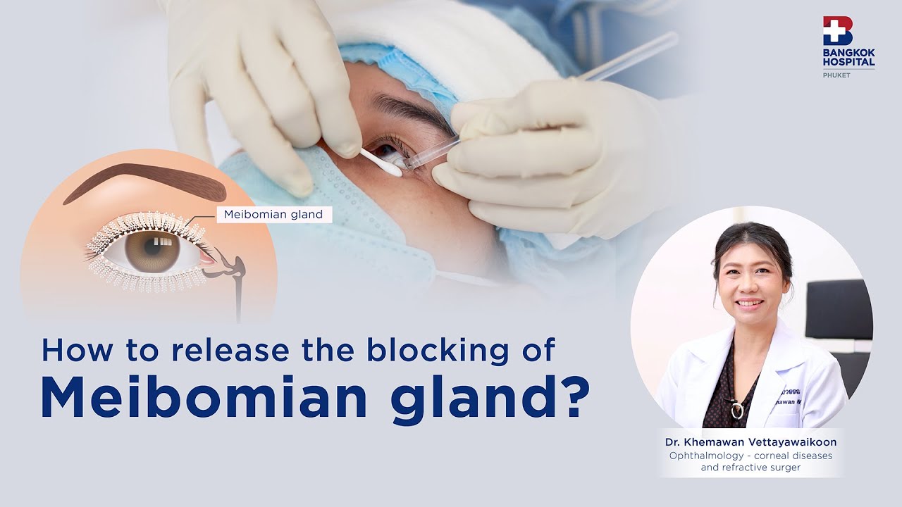 How to release the blocking of Meibomian gland? - YouTube