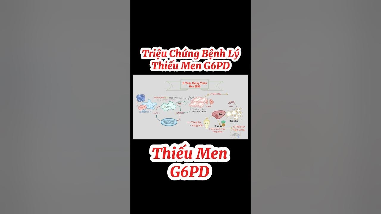 Triệu chứng bệnh thiếu men G6PD | điều trị bệnh thiếu men G6PD | Y Dược TV - YouTube
