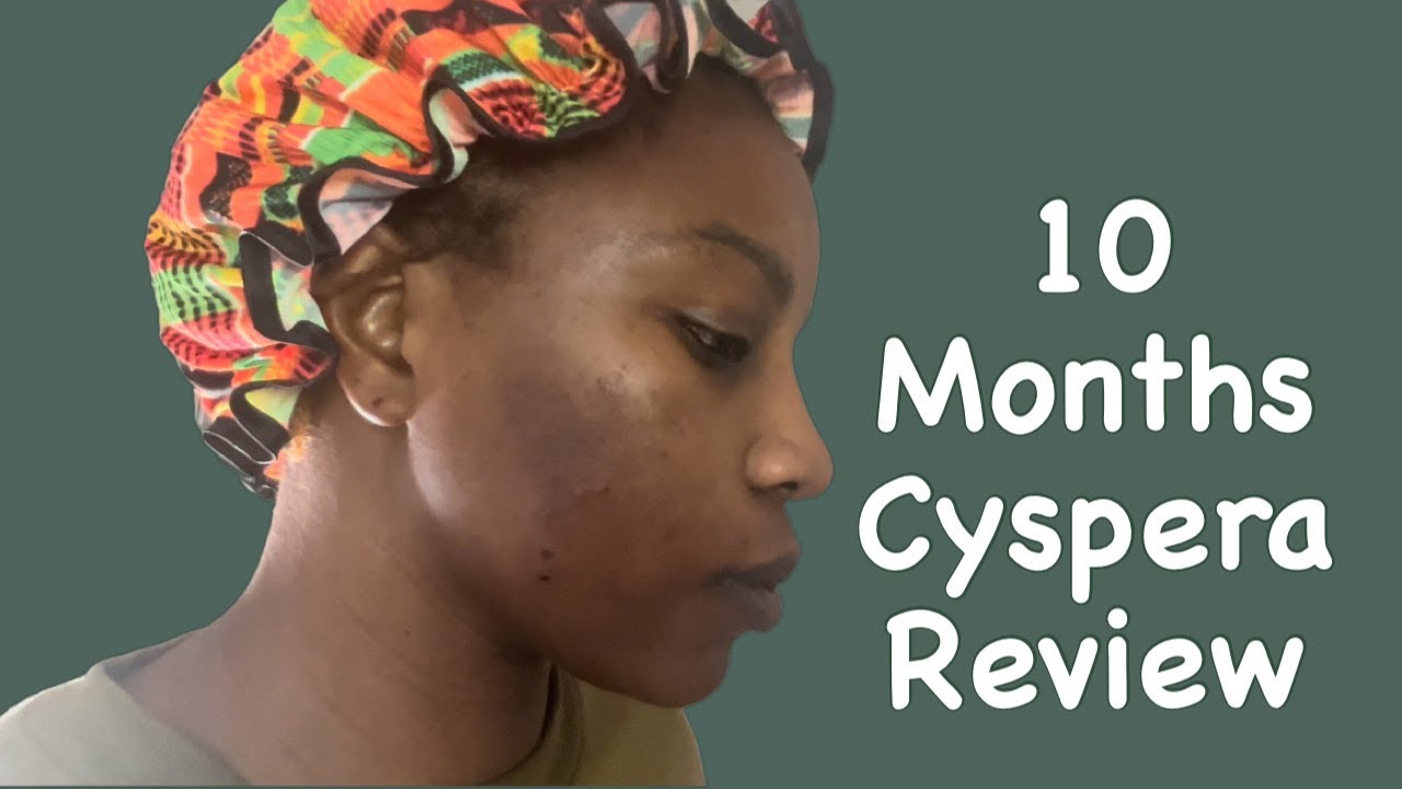 Cyspera Before And After 10 Months Review Answering Questions - YouTube