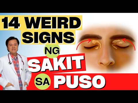 14 Weird Signs ng Sakit sa Puso. -By Doc Willie Ong (Internist and ...
