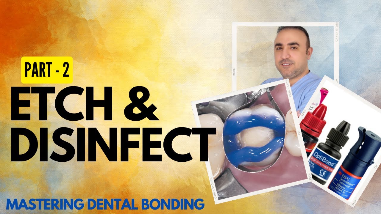 2- Mastering Bonding Essentials: Etching Techniques, Dry vs. Wet ...