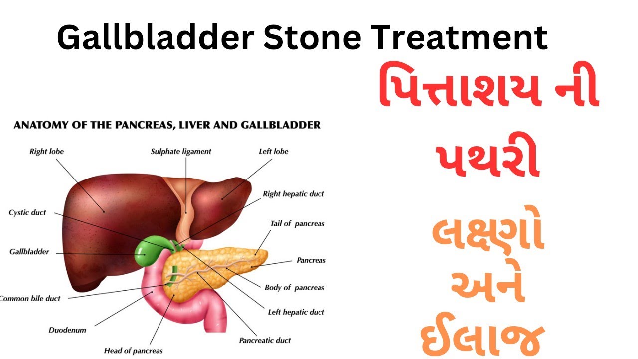 Gallbladder Stone Treatment YouTube gallbladder-stone-treatment-youtube