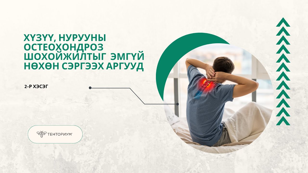 ХҮЗҮҮ НУРУУНЫ ШОХОЙЖИЛТЫГ ЭМГҮЙ НӨХӨН СЭРГЭЭХ АРГА 2 Youtube