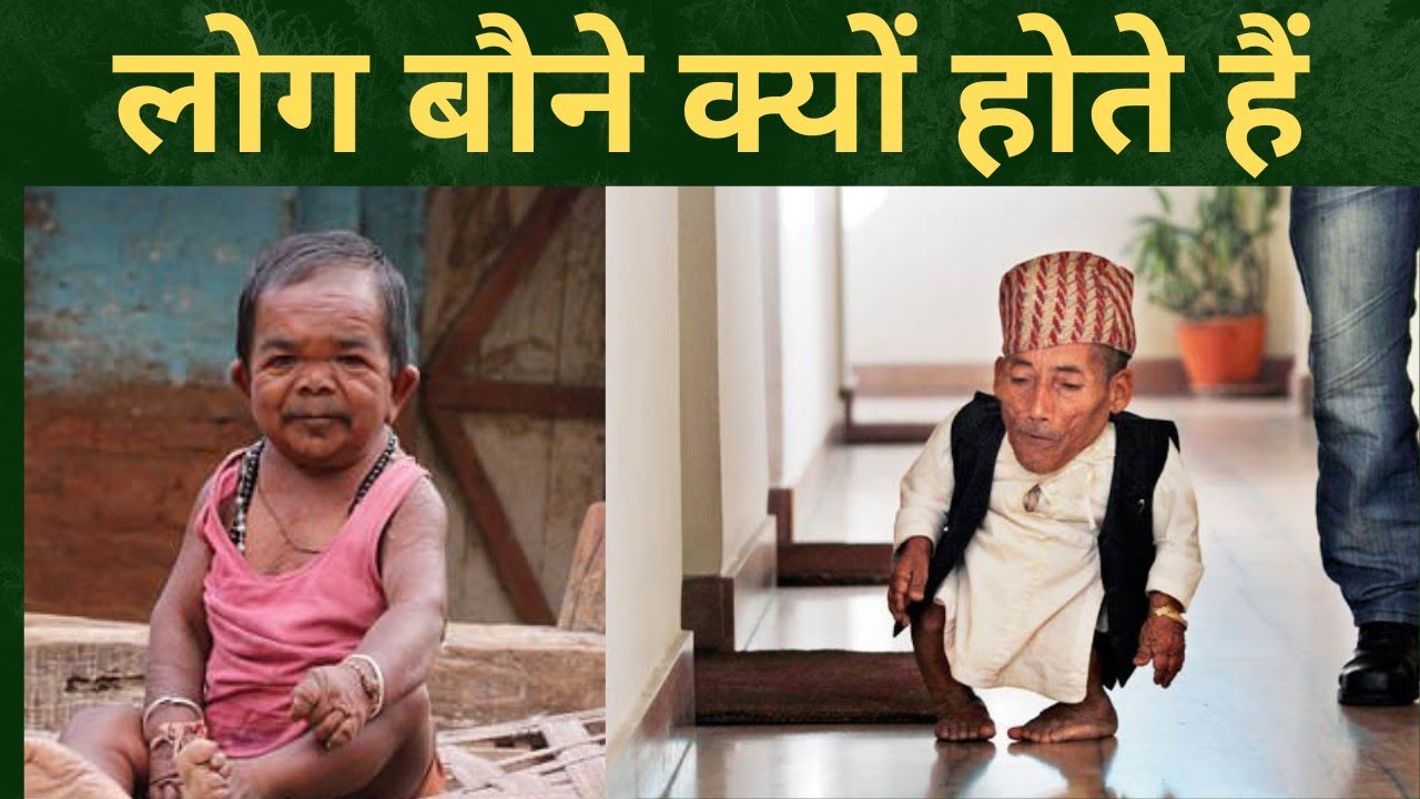 लोग बौने क्यों होते हैं || Why Some People are Dwarf || Log Bauna Kaise ...