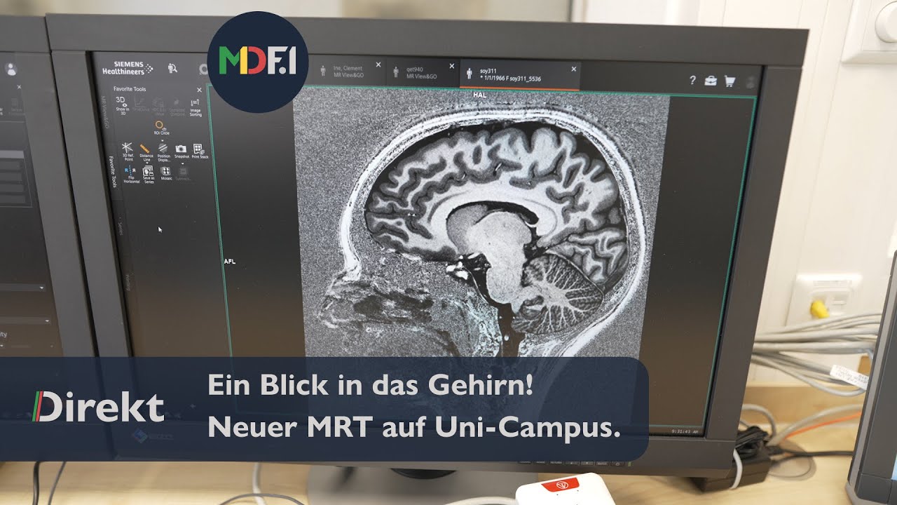 Neuer 7-Tesla-MRT - YouTube