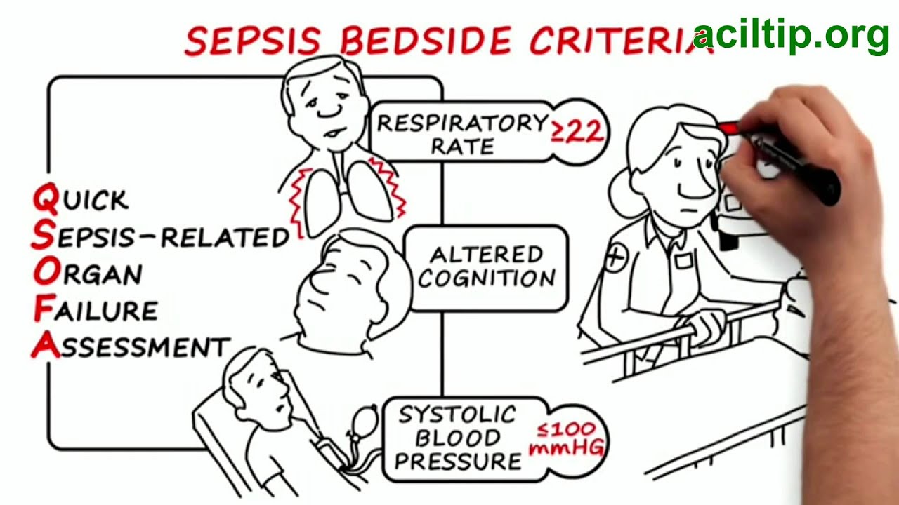 sepsis 3.0 video - YouTube
