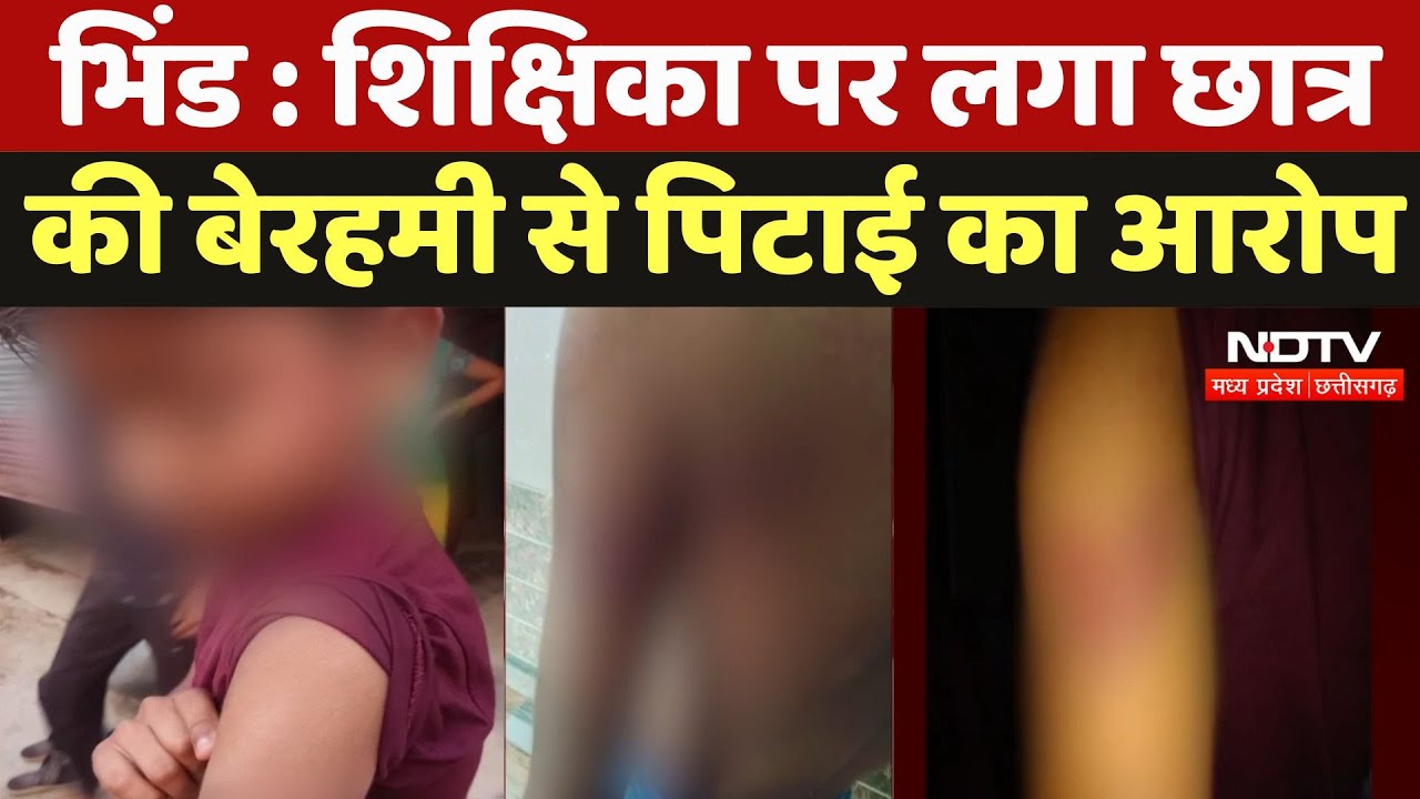 Bhind : शिक्षिका पर लगा छात्र की बेरहमी से पिटाई का आरोप | Breaking ...