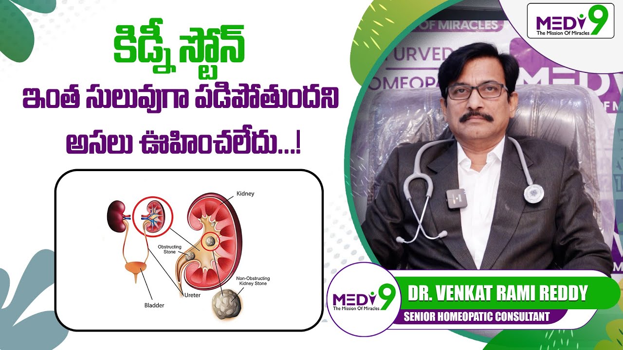 Kidney Stones Symptoms Treatment 9mm Stone Removal Without Surgery Kidney Stones Symptoms Treatment 9mm Stone Removal Without Surgery