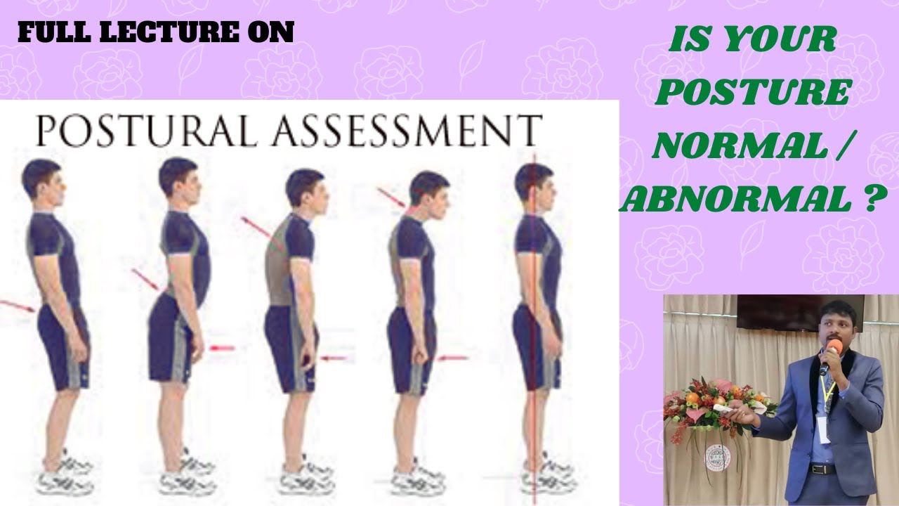 POSTURAL ASSESSMENT- Lordosis, Sway back deformity, Kyphosis , Round ...