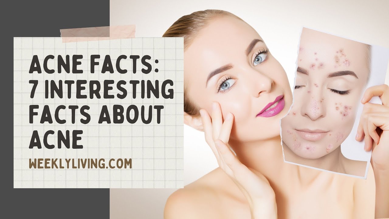 Acne Facts – 7 Interesting Facts About Acne - YouTube