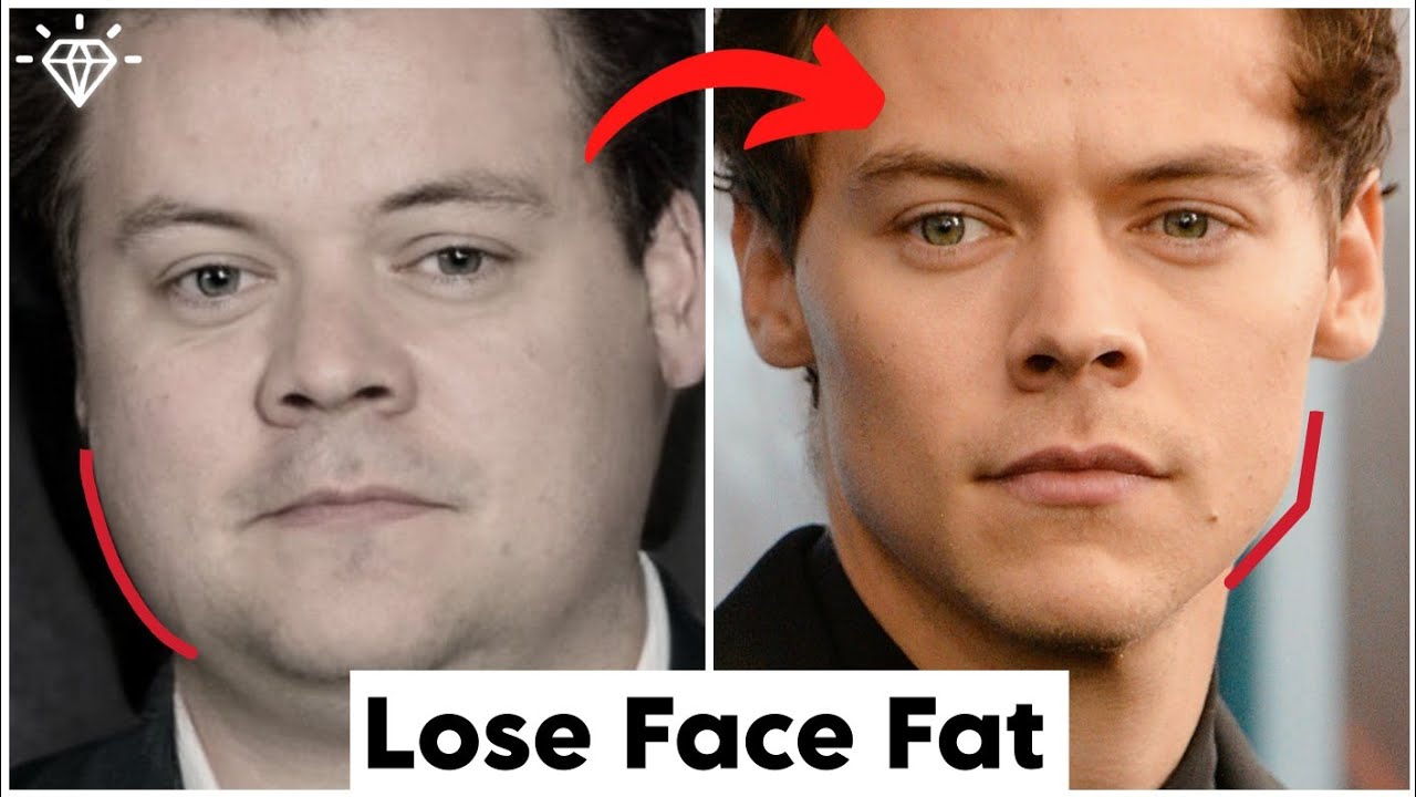 How To Lose Face Fat ( 5 Amazing Tips) | Medical Student Advices - YouTube