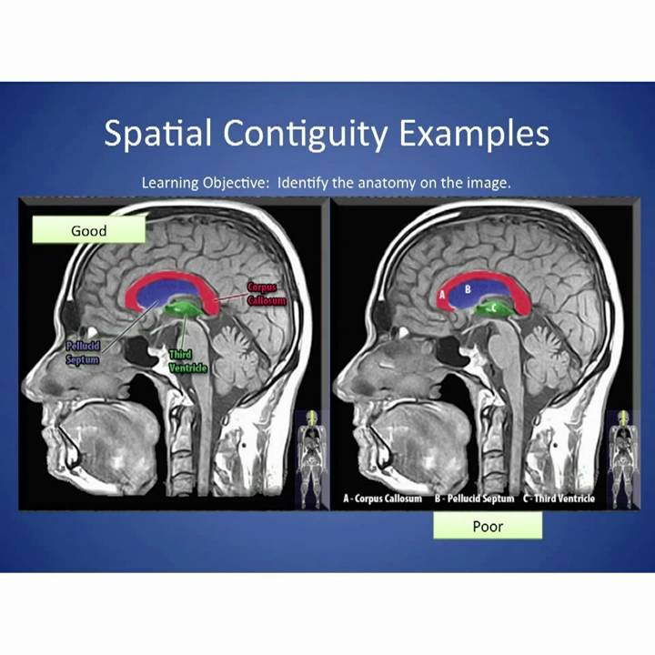 Contiguity Principle - YouTube