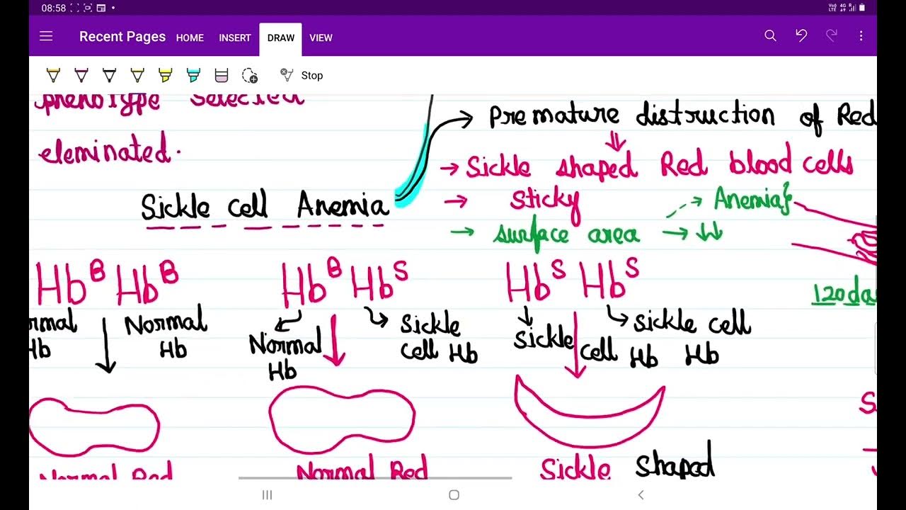 malaria and sickle cell anemia in natural selection #neetbiology # ...