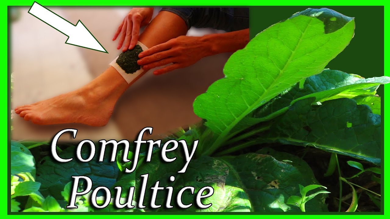 What You Need To Know To Make A COMFREY Poultice | A Permaculture ...