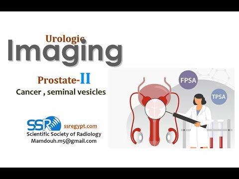 10- Imaging of the prostate TRUS ,CT, MRI (II) - Prof Mamdouh Mahfouz ...