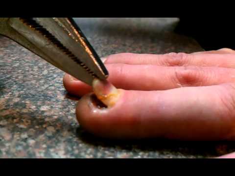 ouch my finger - YouTube