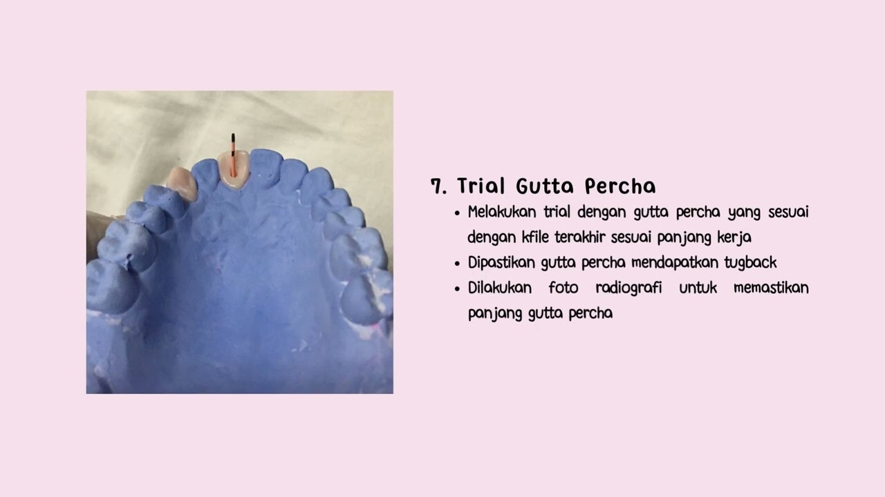 Perawatan Saluran Akar TUnggal / Endodontik Tunggal Teknik Konvensional ...