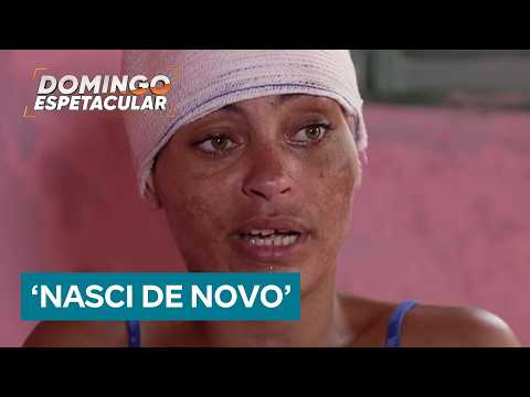 ‘Nasci de novo’, conta mulher dada como morta após atropelamento
