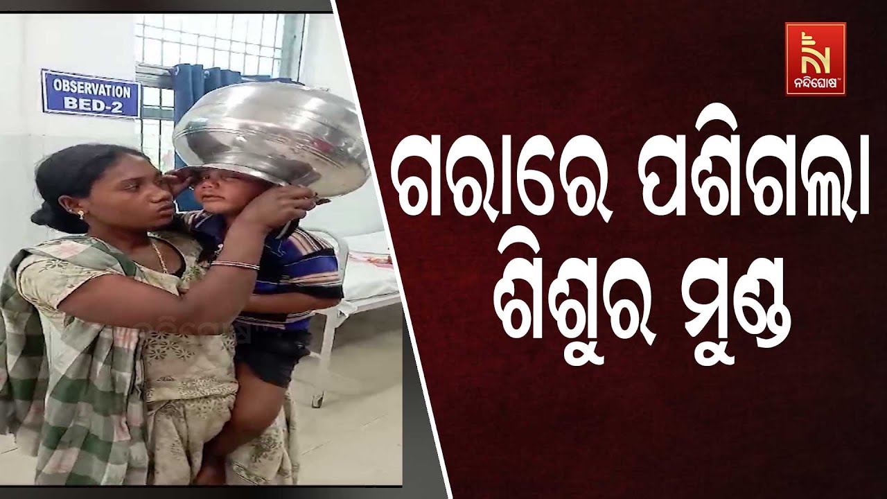 4-year-old Kid With Head Stuck in Water Container Rescued in Sundargarh ...
