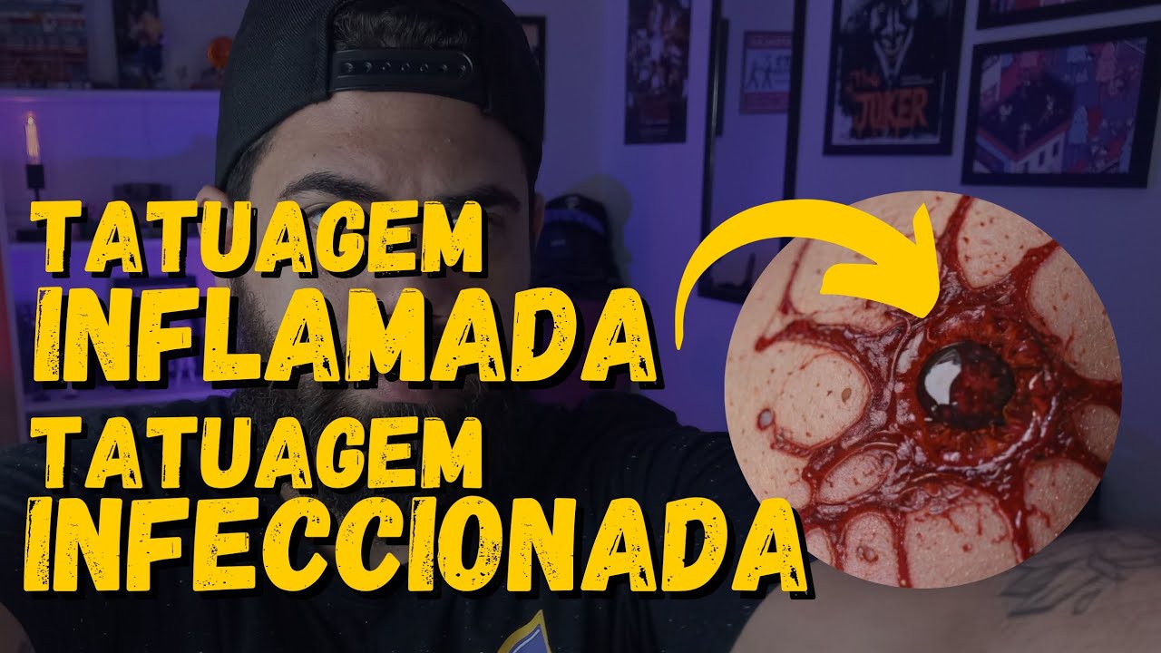 DIFERENÇA ENTRE TATUAGEM INFLAMADA E TATUAGEM INFECCIONADA - YouTube