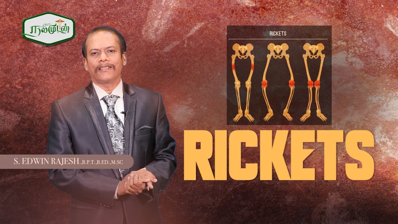 நலமுடன் || RICKETS || NALLAMUDAN || S.Edwin Rajesh B.P.T.,B.Ed - YouTube
