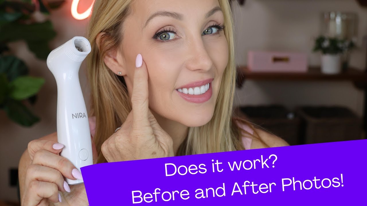 I Tried NIRA PRO For 5 Months | Before and After Pics - YouTube