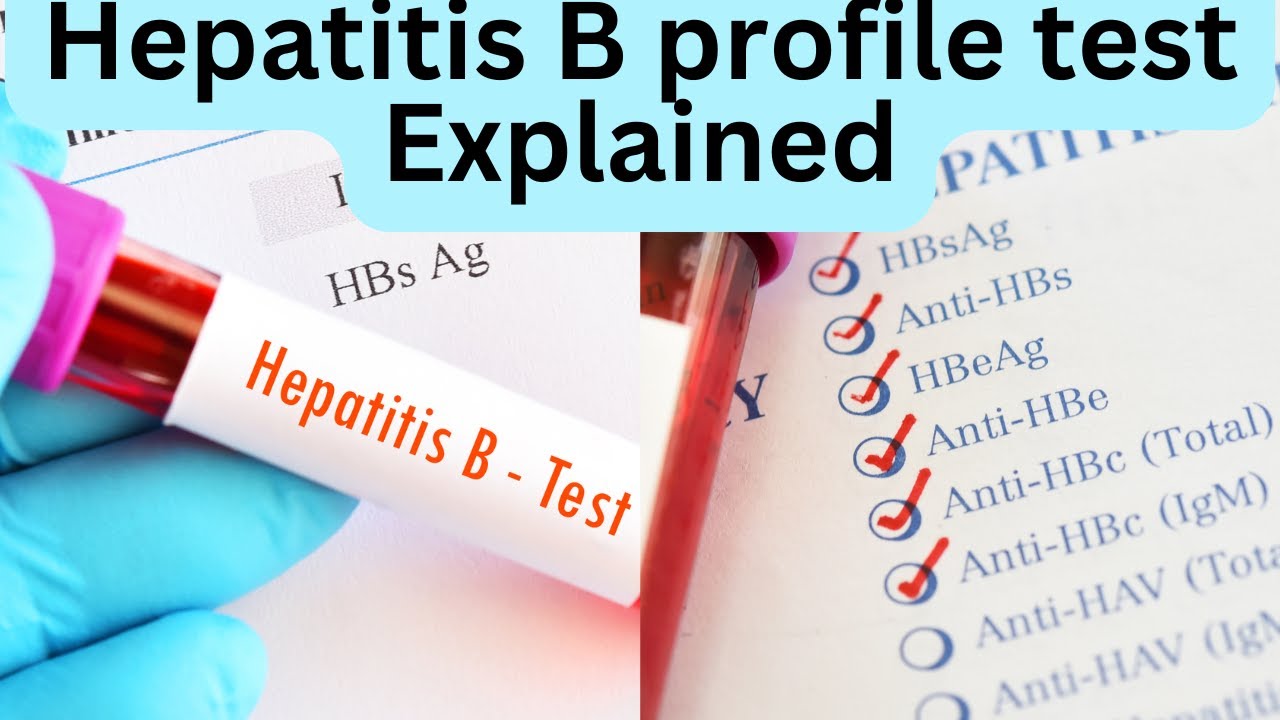 What is Hepatitis B Profile Test. A Layman’s Guide - YouTube